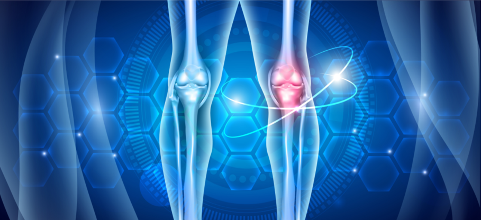 Happy Capital site de financement participatif - Equity crowdfunding